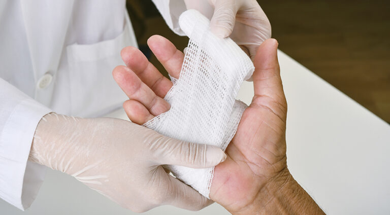 Have You Accidentally Stabbed Your Hand? Here’s What to Do. - CHARMS ...